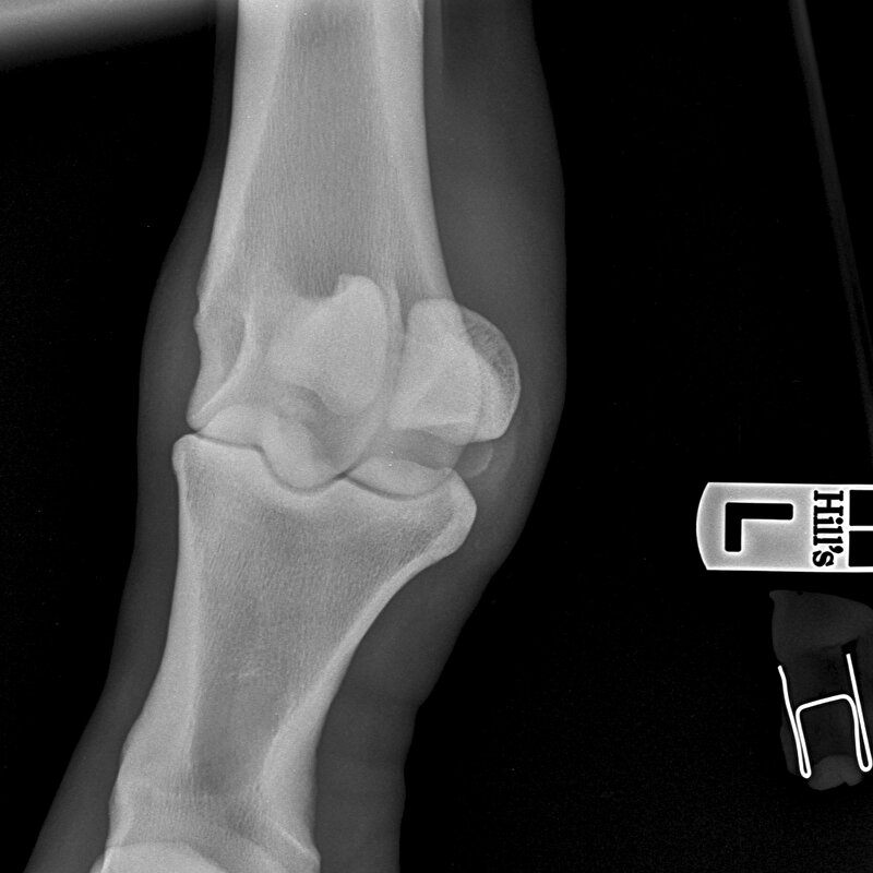 ocd-avulsie tips en advies gevraagd • Bokt.nl