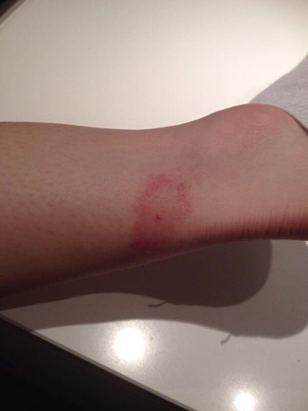 insectenbeet • Bokt.nl