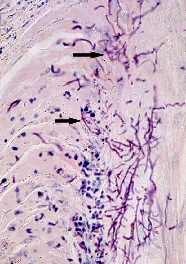 Dermatophilus congolensis - Paarden-encyclopedie